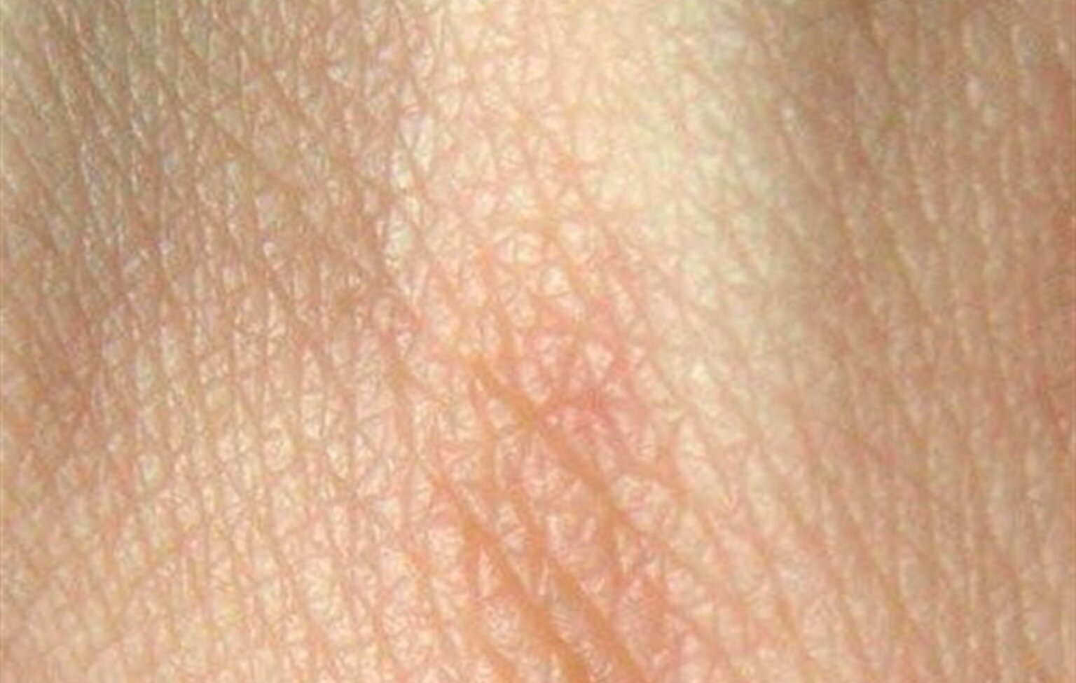 Crepey Skin: Causes Treatment and Prevention - 50 Friendly