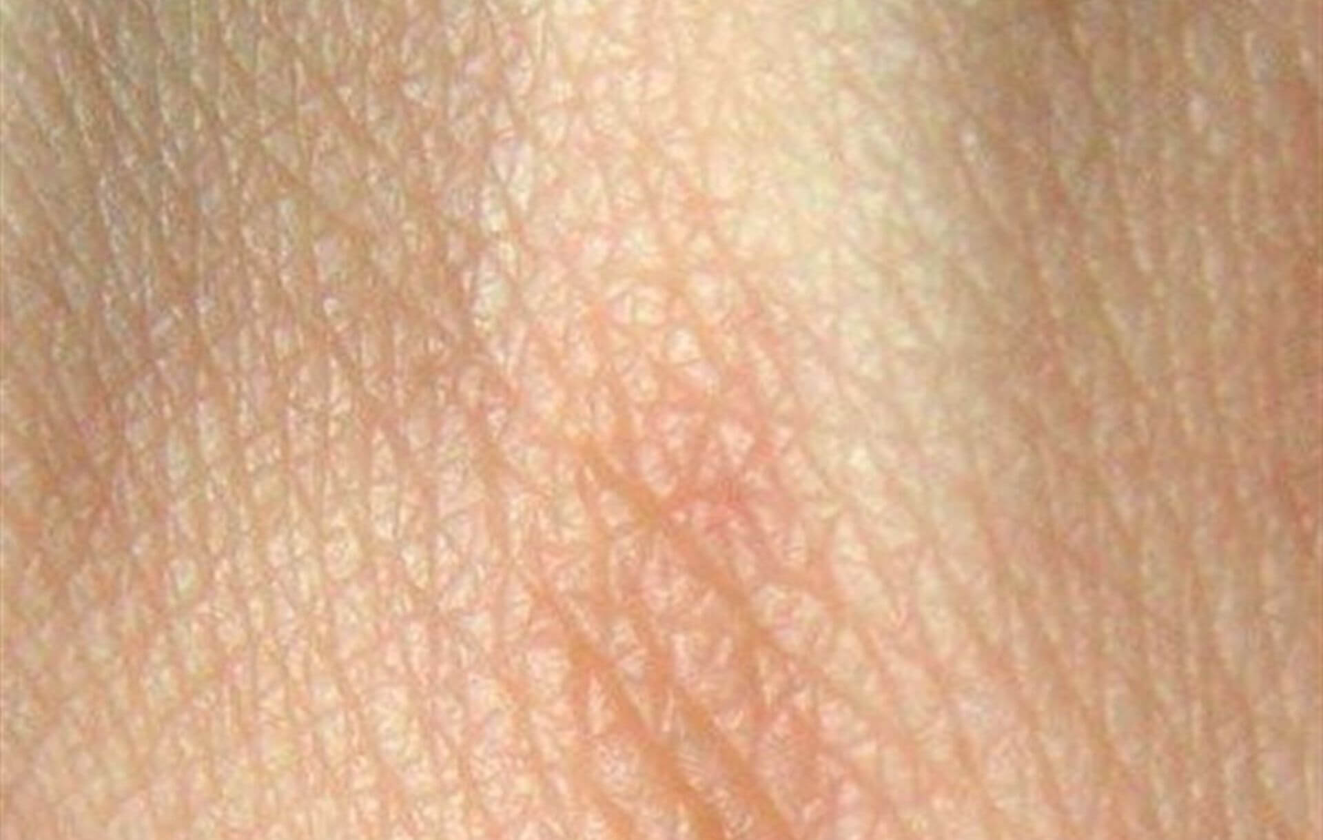 Crepey Skin: Causes Treatment and Prevention - 50 Friendly