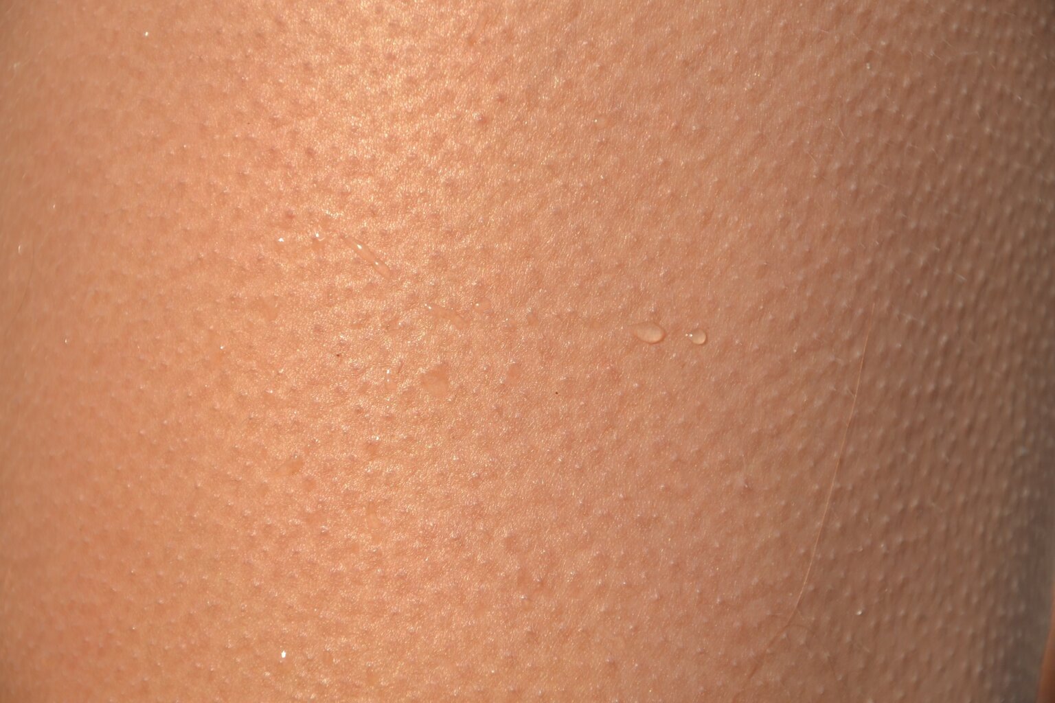 Crepey Skin: Causes Treatment and Prevention - 50 Friendly